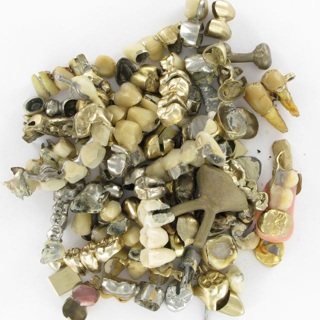 Pressetext - Pressebilder Zahngold / Dentalgold / Goldkronen | ESG