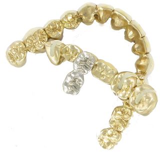 Zahngold Ankauf - Zahngold, Goldkronen, Dentalgold verkaufen