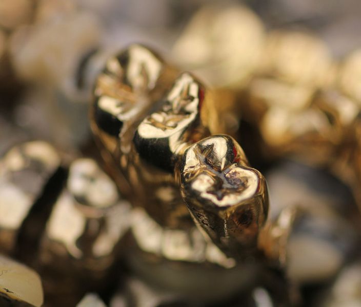 Zahngold Ankauf - Zahngold, Goldkronen, Dentalgold verkaufen | ESG
